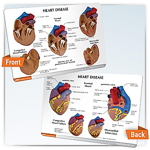 Heart Model Set | Human Body Anatomy Replica Heart Disease Set for Doctors Office Educational Tool | GPI Anatomicals