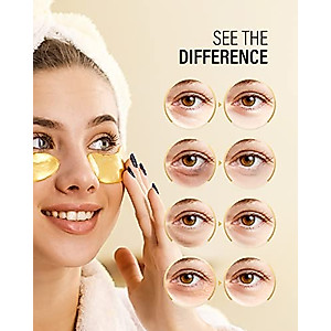 Maskiss 25-Pairs 24K Gold Under Eye Patches, Eye Mask, Eye Patches for Puffy Eyes, Eye Masks for Dark Circles and Puffiness, Collagen Skin Care Products