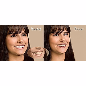 Imako Cosmetic Teeth 2 Pack. (Large, Natural) Uppers Only- Arrives Flat. Fit at Home Do it Yourself Smile Makeover!