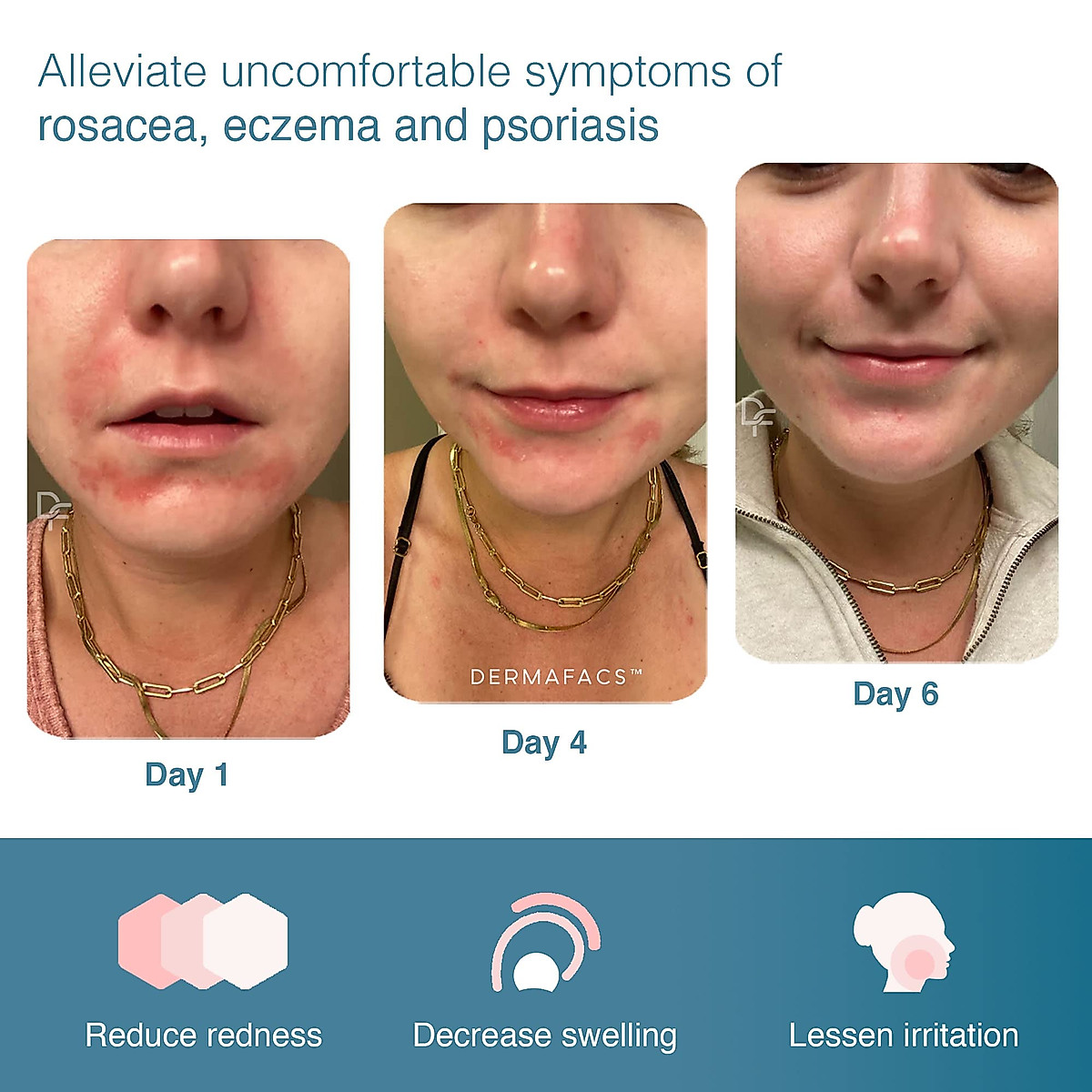 DERMAFACS RecoverX - Advanced Skin Repair Treatment - Silicon Based HSX Formula - Improve Damaged Skin