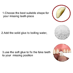 sowsmile Upper and Lower Temporary Missing Teeth Tooth Gap Repair Fix Replacement Solution, Confident Snap on Instant Perfect Smile kit