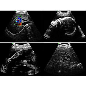 SonoQue o2 Lifecare Wireless Veterinary Ultrasound Scanner Probe (3.5-5MHz : 128 Elements) - Convex Transducer for iPad, iPhone Smartphones