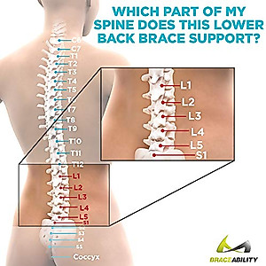 BraceAbility Lower Back & Spine Pain Brace | Adjustable Corset Support for Lumbar Strain, Arthritis, Spinal Stenosis and Herniated Discs (One Size - Fits Men & Women with 28" - 60" Waist)