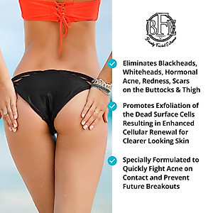 Anti-Acne Buttocks & Thigh Treatment- Clears Away Acne, Pimples, and Ingrown Hairs for the Buttocks and Thigh Area. Prevents Future Breakouts. 6.9 OZ