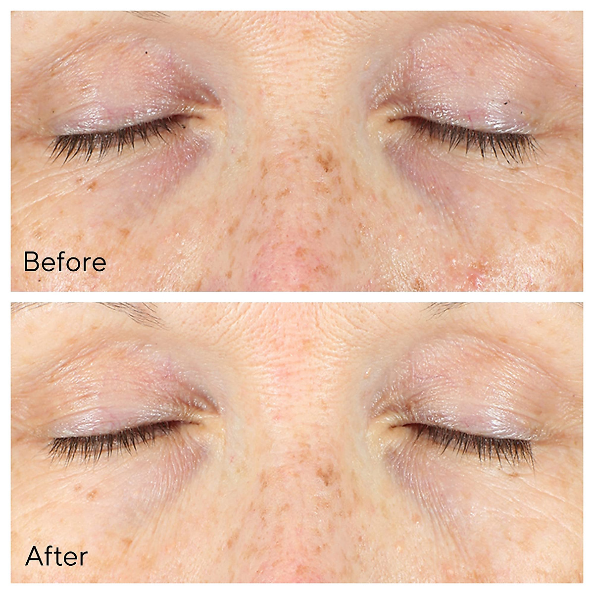 Murad Vita-C Eyes Dark Circle Corrector – Environmental Shield Vitamin C Brightening Serum – Anti-Aging Treatment for Puffiness and Wrinkles, 0.5 Fl Oz