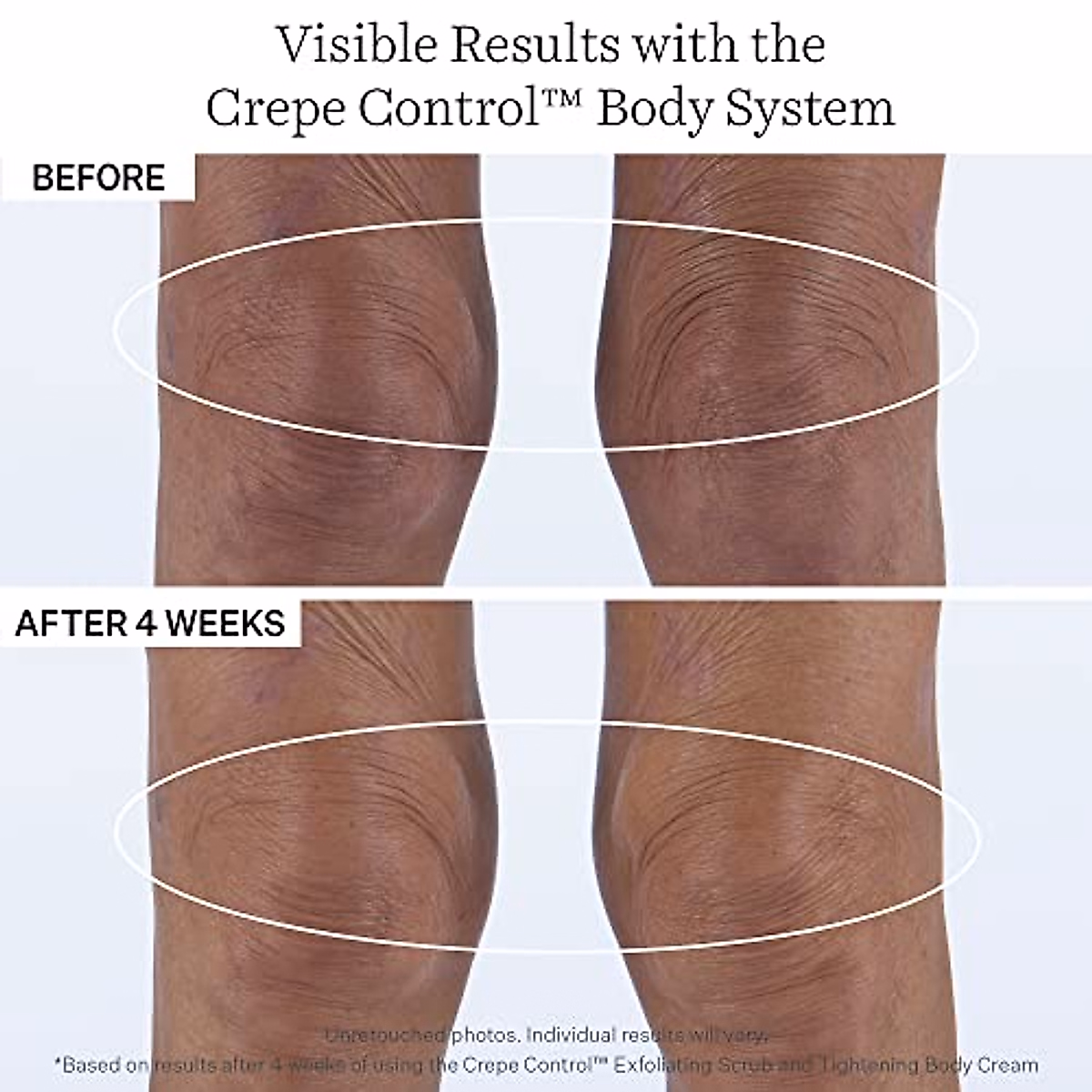 StriVectin Tighten & Lift Crepe Control Tightening Body Cream for Firmer, Brighter Arms & Legs, 6.7 Fl Oz