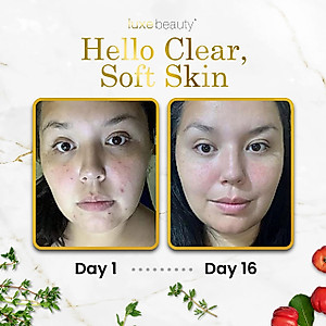 Luxe Cleanser All-in-One Hypoallergenic Face Cleanser + Natural Makeup Remover Face Wash + Exfoliator for All Skin Types – No Parabens, No Silicones – W/ Organic Botanicals: Thyme, Pineapple & Papaya