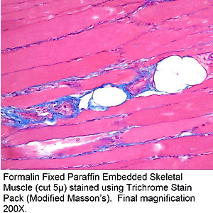 Trichrome Stain Pack (Modified Masson’s), 500ml