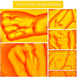 Vein Finder, Portable Blood Vessel Finder, Medical Vein Image Display Instrument, Infrared Vein Finder Viewer Light with 5 Modes for Elderly Adult Children Easy Finding Subcutaneous Veins