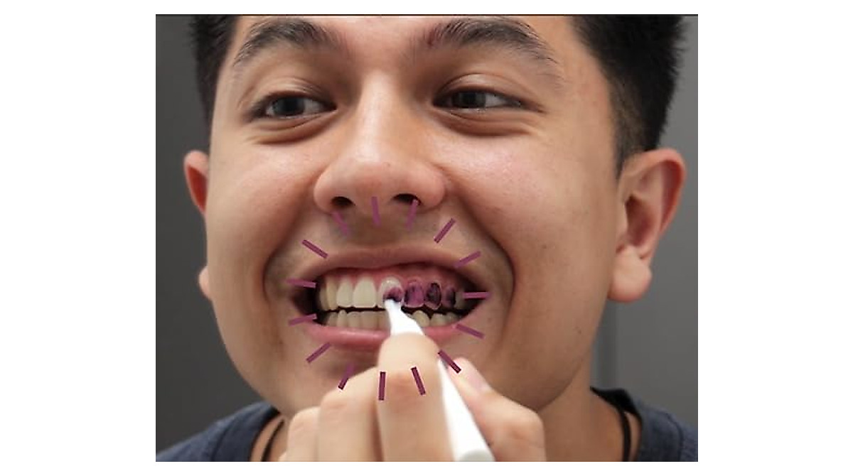 Plaque Disclosing Gel Pens for Teeth - Brighten & Teach Good Habits