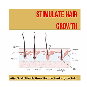 Chebe Butter For Hair Growth. Manuka Honey (Biotin+MSM)| Alopecia Growth Stimulant | Great For Balding/Bald Spots. Chebe Hair Butter, With Chebe Powder. (Chebe Hair Balm)