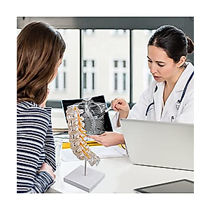 Ultrassist Human Lumbar Spine Model with Sacrum, Spinal Nerves and Herniation Disc, Includes Base for Display, Life Size Spine Model for Medical Education