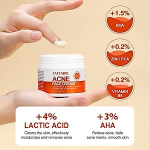 Acne Treatment for Face, Acne Cream Back Acne Treatment Cream for Teens & Adults Anti-acne Pimple Cream Butt Acne Clearing Cream, Acne Spot Treatment
