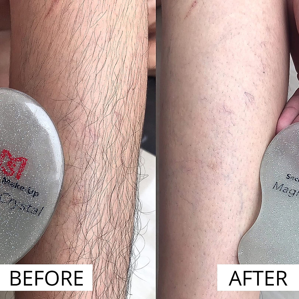 Magic Crystal Painless Hair Remover for Men and Women (New Technology) Fast & Easy - Soft Smooth Silky Skin, Clear Glitter