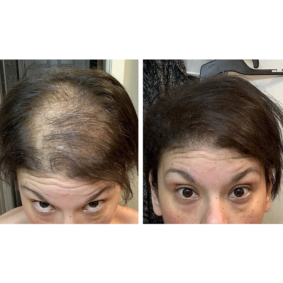 Caboki Hair Loss Concealer, 90-day supply, Dark Brown