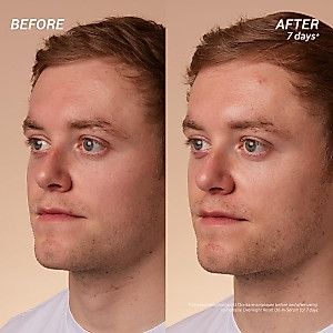 L'OCCITANE Immortelle Overnight Reset Oil-In-Serum: More Radiant Skin In 1 Night, Smooth Fine Lines, Revitalize Dull Skin, Award-Winner, With Immortelle Essential Oil, 1.6 Fl. Oz