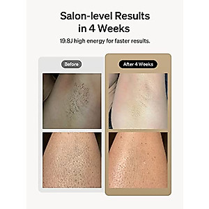 Ulike Laser Hair Removal for Women and Men, Air+ IPL Hair Removal Device with Sapphire Ice-Cooling Technology for Painless Result, Safe and Long-Lasting for Reducing in Hair Growth for Body & Face