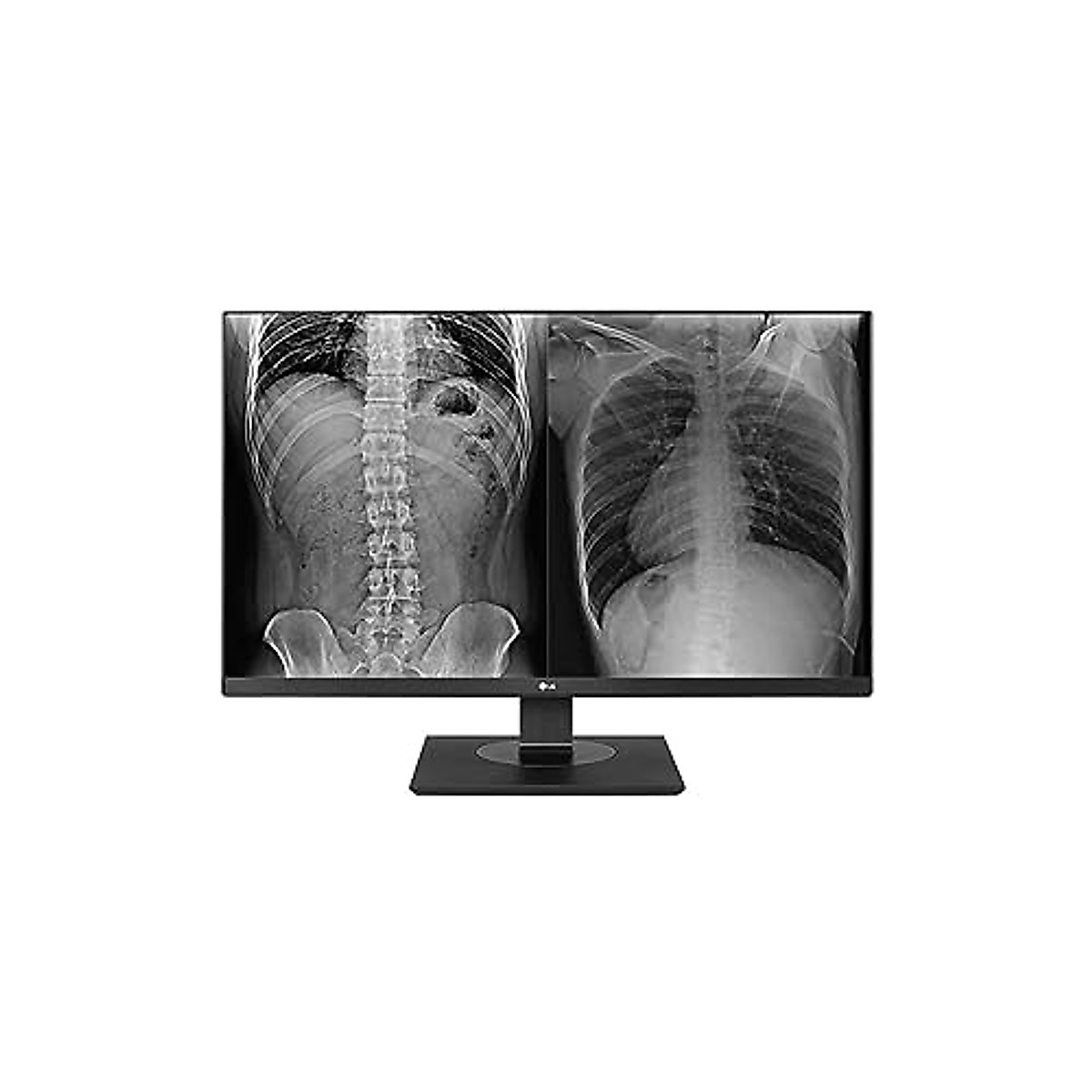 LG 27IN 3840X2160 IPS 8MP Clinical Review Monitor