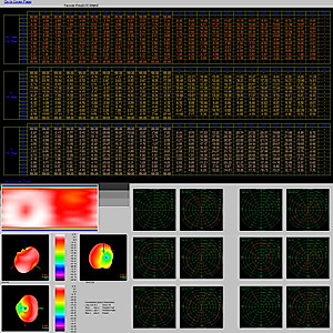FPV Small WiFi Antenna 2.4GHz Bluetooth Mini WiFi Antenna Wireless Omni Thumb Antenna mmdvm Network Router RP SMA Male TX RX Mini RHCP Racing Drone Antenna for Multicopter Back Up Camera Pack of 2
