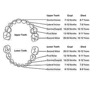 PDTXCLS SPPRANDOM HLXFF3 Aeiniwer Blackpaistar Baby tooth box, baby tooth protector container, lovely Andromeda wooden tooth collector (girl)