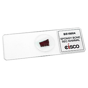 25pk Spongy Bone Section (Mammal), Prepared Microscope Slides - 75 x 25mm - Classroom Pack, 25 Slides in Storage Case - Anatomy, Biology & Microscopy - Eisco Labs