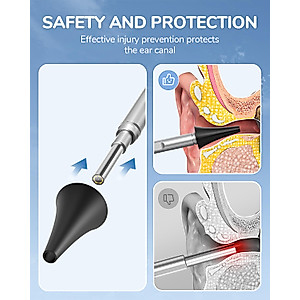 Ear Specula Set for ScopeAround Digital Otoscope, Set of 50 Pieces, Replacement Otoscope Tips, Ear Speculum, Compatible with ScopeAround SA39W/SA39i/M28/MS450 Otoscope