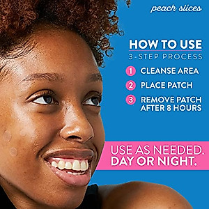 Peach Slices | Acne Spot Dots | Hydrocolloid Acne Patches | For Zits, Blemishes, & Breakouts | Vegan | Cruelty-Free | Pimple Patches | Facial Skin Care Products | 3 Sizes (7mm, 10mm, & 12mm) | 30 Ct