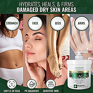 Advanced Clinicals Retinol Body Cream & Collagen Body Lotion Skin Care Set. Anti-Aging Body & Face Moisturizing Creams Repair Wrinkles, Fine lines, & Firm Sagging Skin. 16 Oz (2-Pack Bundle)