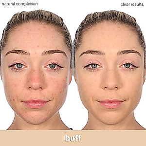 Almay Clear Complexion Acne Foundation Makeup with Salicylic Acid - Lightweight, Medium Coverage, Hypoallergenic, -Fragrance Free, for Sensitive Skin , 200 Buff, 1 fl oz.