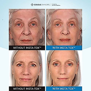 Serious Skincare Insta-TOX Instant Wrinkle Smoothing Serum - Tightens Skin - Facial Serum - Instant Line Filler - .75 oz. (1-Pack)