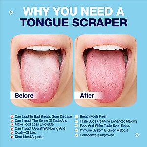Tongue Scraper & Cleaner for Adults (2 Pack) Healthy Oral Care, Easy to Use, Help Fight Bad Breath (Pink & Blue)