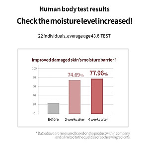 SECRETKEY Starting Treatment Essence Rose Edition, Nourishment & Hydration, Skin Soothing, Skin-texture Care, 94% of Galactomyces and Rose Water Synergy 5.07 fl. Oz. / 150ml, For Sensitive Skin