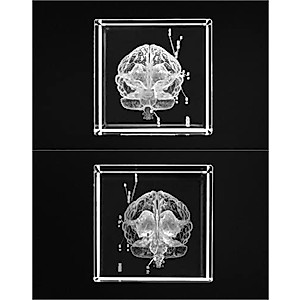 QWORK 3D Human Brain Anatomical Model, Laser Etching Crystal Glass Cube Science Gift Paperweight (LED Base not Included), 3.1(L) x2(W) x2(H) inches
