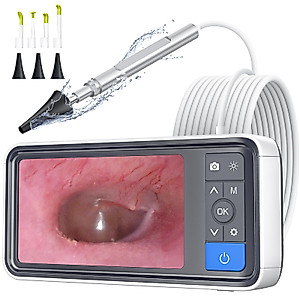 Ear Specula Set for ScopeAround Digital Otoscope, Set of 50 Pieces, Replacement Otoscope Tips, Ear Speculum, Compatible with ScopeAround SA39W/SA39i/M28/MS450 Otoscope