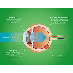 Premium Anti Blue Light and Anti Glare Screen Protector (2 Pack) for 20 inches (Measured Diagonally) Monitor. Screen Protector Size is 17.4" Width x 9.8" Height. Easy and Bubble Free Installation