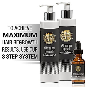 Hair Regrowth Serum- Maximum Strength DHT Blocker. Repairs & Stimulates New Follicle Hair Growth. Grow Stronger, Thicker, Fuller, Longer, Healthier Hair. For Men & Women with No Side Effects.