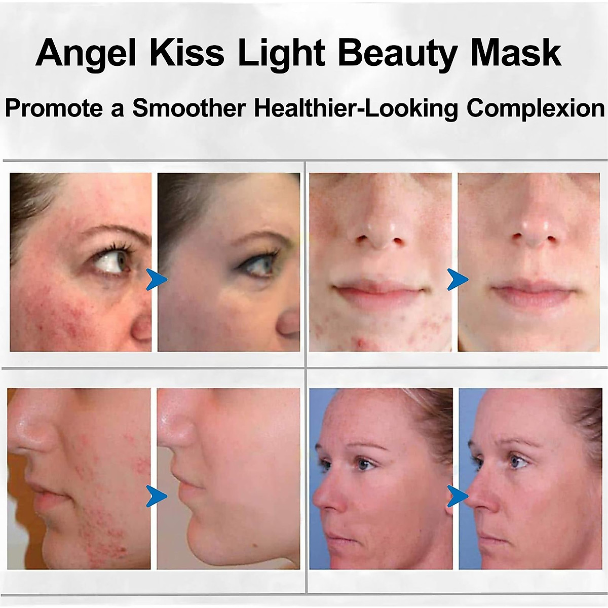 Angel Kiss Light Beauty Mask - Led Face Mask Light Therapy - Red Light Therapy Mask for Face - LED Facial Skin Care Mask