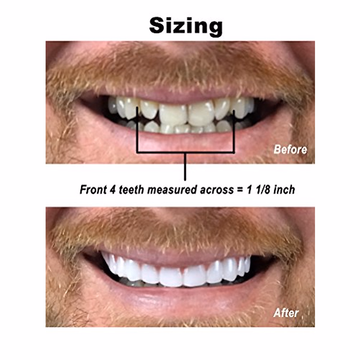 Billy Bob Instant Smile Comfort Fit Flex Cosmetic Teeth, Bright White Shade, Comfortable Upper Veneer, 1 Size Fits Most