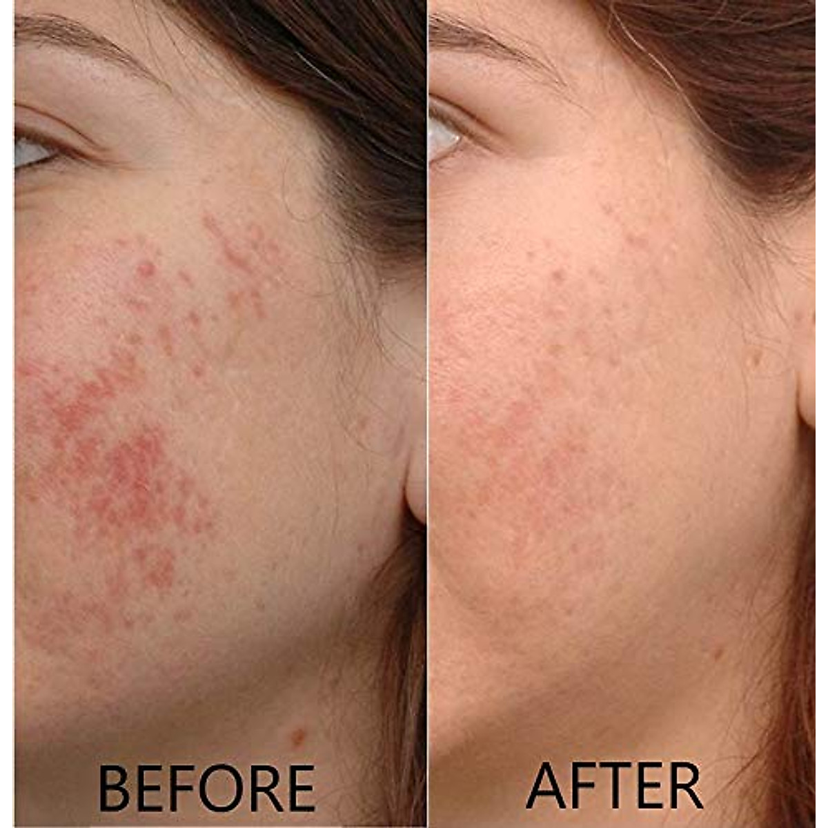 Vitamin C Serum 20% Pure L-Ascorbic Acid, Ferulic Acid, Vitamin E and HA and Hyaluronic Acid Serum with Vitamin B5 for Face and Eyes Natural Anti Aging Anti Wrinkle Set of 2 by Dr. Brenner