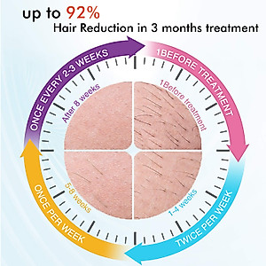 IMENE Permanent Hair Removal Machine for Women & Men, 500,000 Flashes IPL Hair Removal System with Ice Care Function for Full Body Home Use Hair Removal-Safest and Fastest IPL Technology