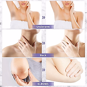 Acclyd Dark Spot Corrector Skin Lightening Cream for Body, Intimate Areas, Underarms, Armpit, Knees, Legs, Elbows and Inner Thigh, Whitening Cream Dark Spot Remover for Sensitive Areas (1.76 Fl Oz)