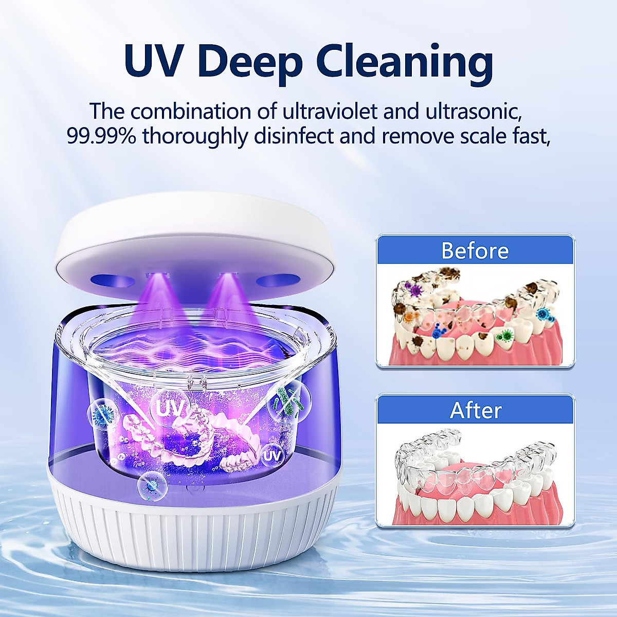 THISONG Ultrasonic UV Cleaner for Dentures, Orthodontic Appliances, Whitening Trays, Toothbrush Heads, Diamond, Jewelry, 5/10 Minutes Ultrasonic Retainer Cleaner with UV Light