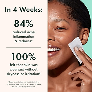 Rael Toner, Miracle Clear Clarifying Toner - Facial Toner for Face, Oily and Acne Prone Skin, Korean Skincare, with Succinic Acid, Hydrating Vitamin B5, Vegan, Cruelty Free (5.1 oz)