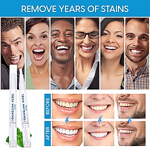 Teeth Whitening Pen - 3 Pens, 35% Carbamide Peroxide, Effective & Painless Whitening, Perfect for Sensitive Teeth, No Sensitivity, Travel-Friendly, Natural Mint Ingredient