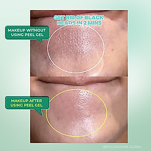 MOTHER MADE Exfoliating Vegan Facial Peeling Gel with Green Tea, Vitamin E, Hyaluronic Acid, 3.38 fl. oz.| Gentle Natural Face Scrub Exfoliator, Cleansing, Physical Peel, Korean Skincare