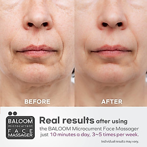 Baloom Microcurrent Facial Massager, Facial Roller - Skin Tightening Care for Women and Men - Face Wrinkle Removal, Anti Aging, Skin Rejuvenation, Lift, Acne Spot Treatment - 10 Minutes A Day.