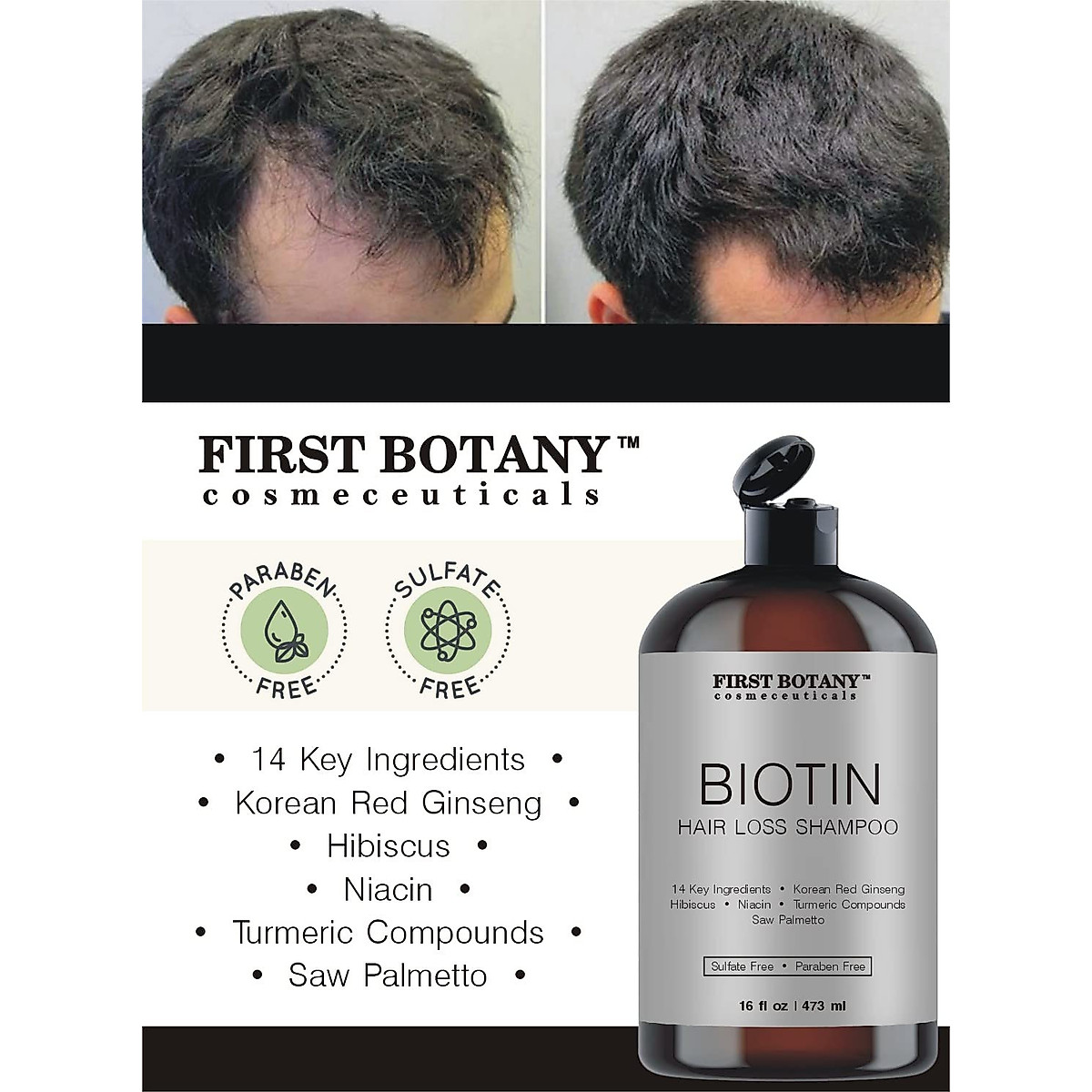 First Botany Cosmeceuticals, Hair Regrowth and Anti Hair Loss Shampoo 16 fl oz, with DHT blockers- Daily Hydrating, Detoxifying, Volumizing Shampoo For Men and Women