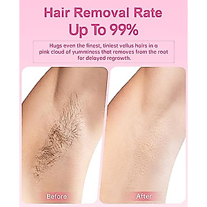 Waxing Kit, Wax Roller, Roll On Wax Kit with 2 Honey & 1 Rose Roll on wax, 50 Non-Woven Wax Strips, Soft Wax Warmer for Hair Removal, At Home Waxing Roller Kit for Larger Areas of the Body