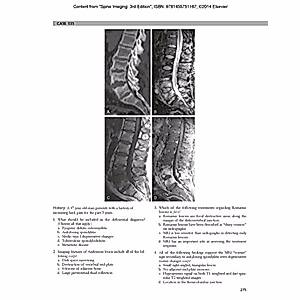 Spine Imaging: Case Review Series: Expert Consult - Online and Print