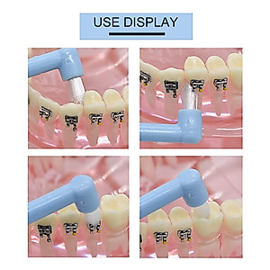 Angzhili 9 Pieces Interspace Toothbrush,End Tuft Orthodontic Toothbrush Tapered Orthodontic Brush for Hard to Reach Areas,Gap Toothbrush for Orthodontic Braces Bridges and Implants